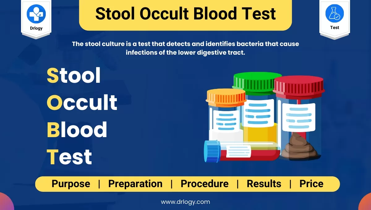 What Are The Most Common Causes Of Occult Blood In Stool What Are The Most Common Causes Of Occult Blood In Stool